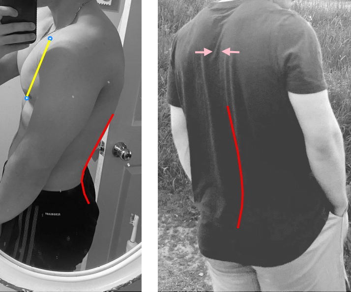 Posture assessment: Lonely-Week-995 | Good Posture Studio Posture assessment: Lonely-Week-995 | Good Posture Studio